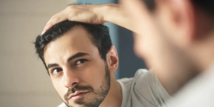What is an M-shaped Hairline? Is it a sign of hair loss?